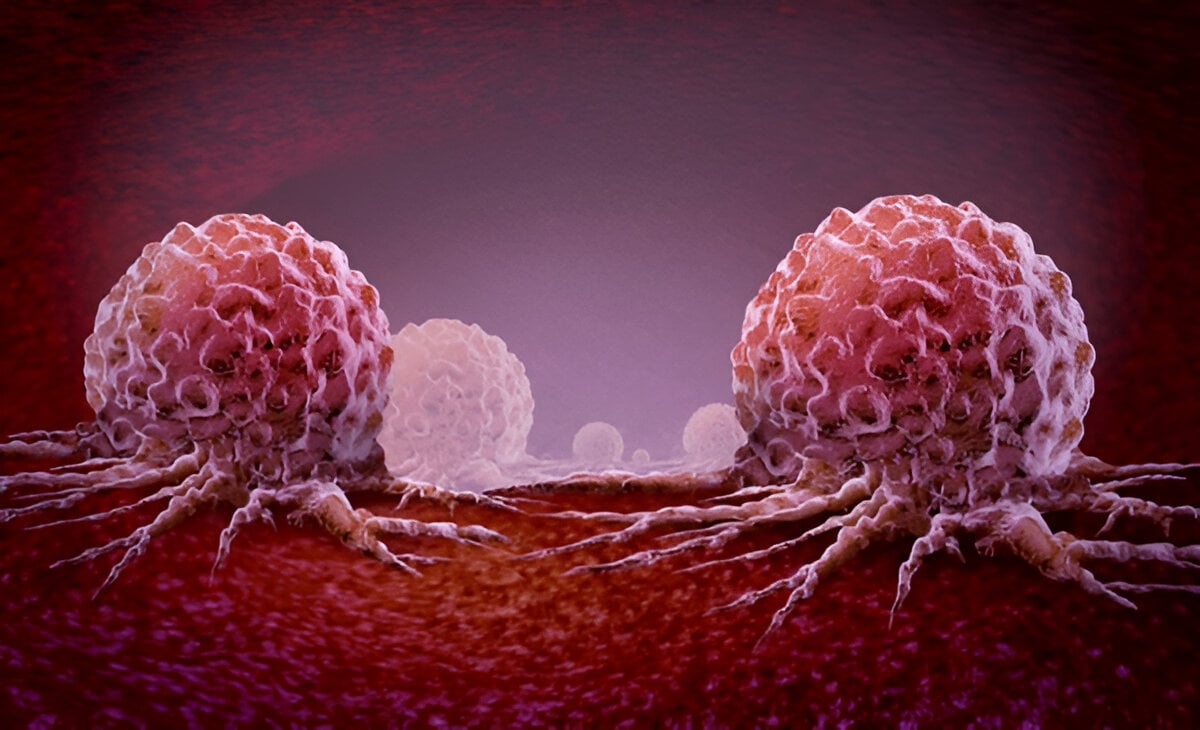 Russian Scientists Create Hair-Thin Laser for Cancer Detection · Daily ...