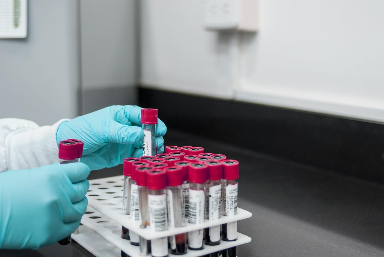 Dr. Dmitry Denisov: Smoking Distorts Blood Test Results · Daily Beirut
